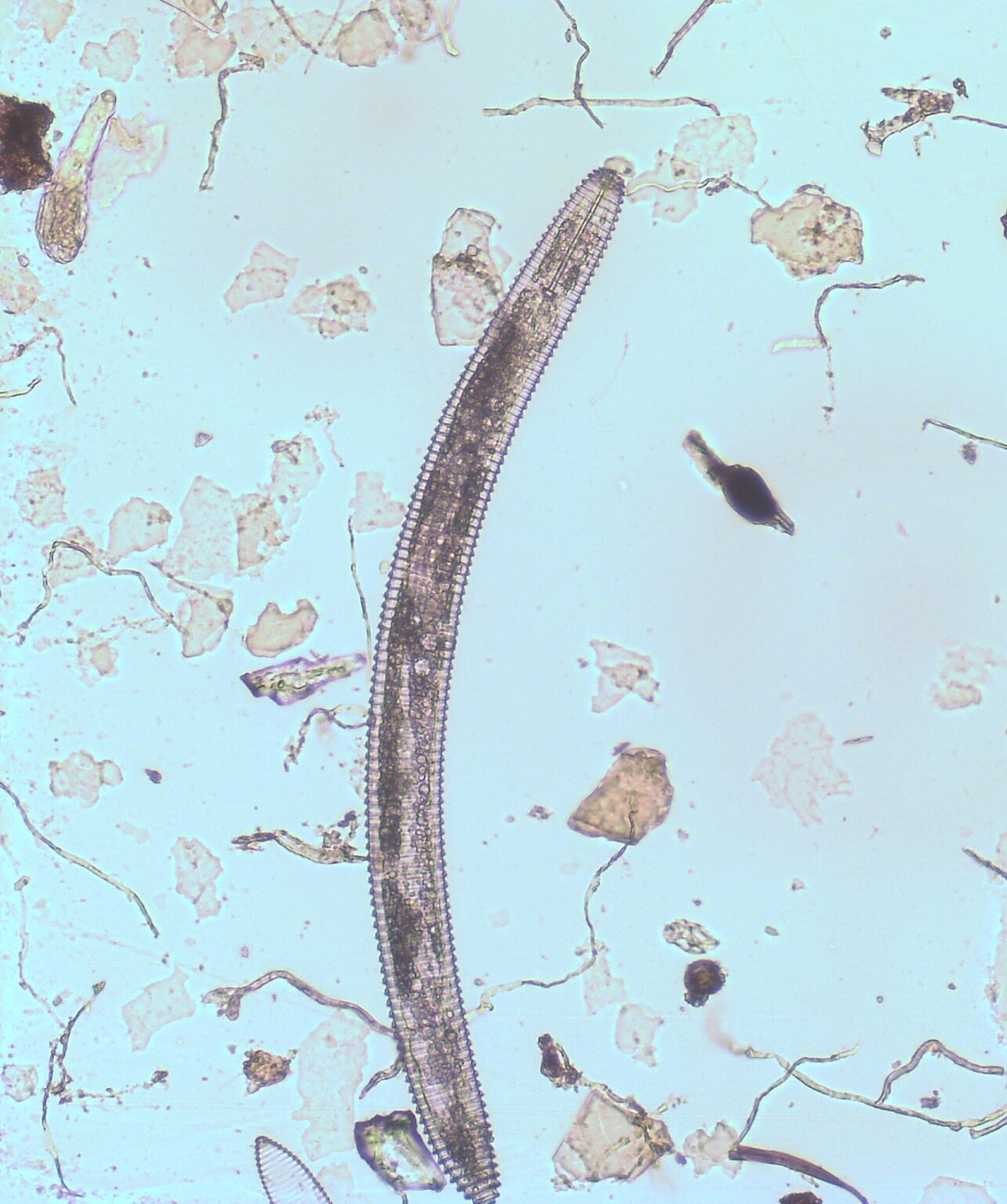 Nematodes Don’t Stand a Chance with TELONE™ by Teleos Soil Fumigant ...